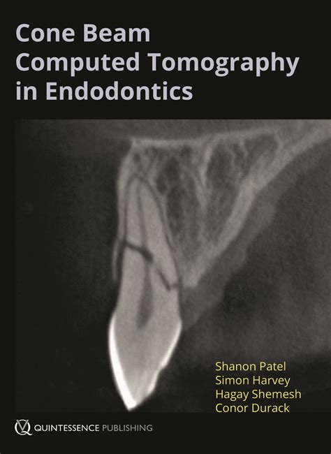 Cone Beam Computed Tomography In Endodontics Dentalbookshop