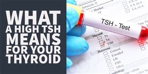 What A High Tsh Really Means For Your Thyroid What Causes It Artofit