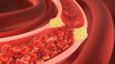 Cholesterol 101 Hdl Ldl And Triglycerides Explained