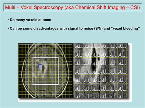 Ppt Dti Basics Water Diffusion In Mri Imaging Powerpoint Presentation Id 9357815