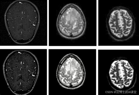 医学图像增强 Csdn博客