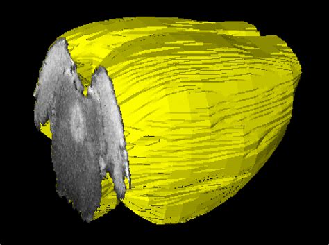 table 1 1 from magnetic resonance image segmentation using pulse coupled neural networks