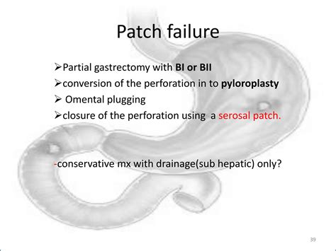 Gi1 Surgical Management Of Pud 2021pptx