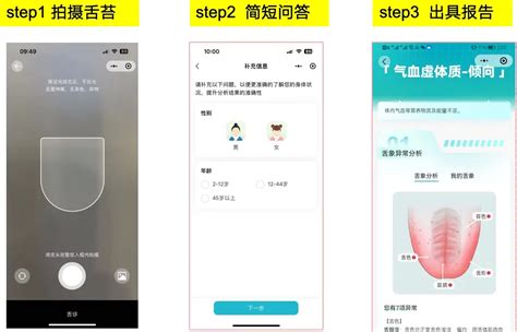 智能中医舌诊：图像识别技术在传统医学中的应用大数据maijing135 2048 Ai社区