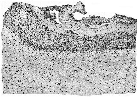 Human Brain Tissue Background Images Hd Pictures And Wallpaper For