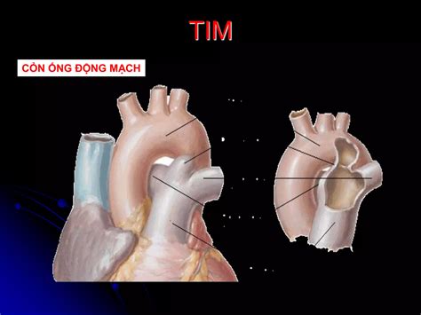 GIẢI PHẪU TIM PDF