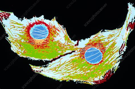 Coloured Tem Of Mammalian Fibroblast Cells Stock Image P780 0058 Science Photo Library