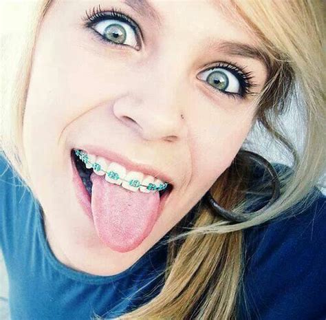 Weirdo Whos Pretty C Braces Colors Cute Braces Cute Braces Colors