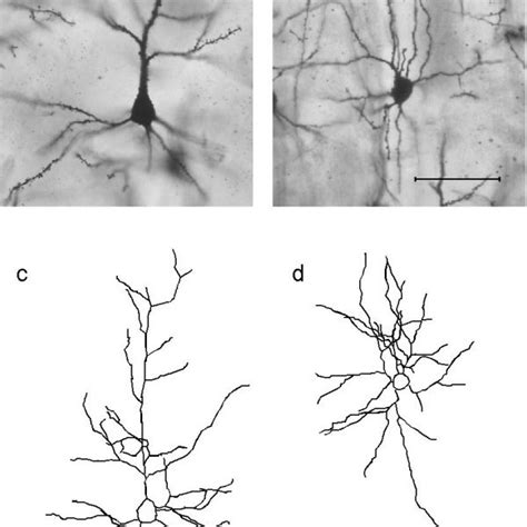 Dendritic Arborization Pattern In The Distal Sectors Of Layer Ii Iii