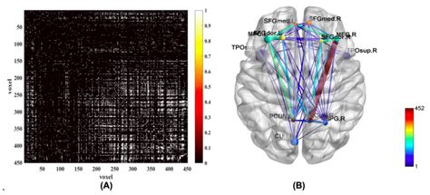 The Identification Of Alzheimers Disease Using Functional Connectivity Between Activity Voxels
