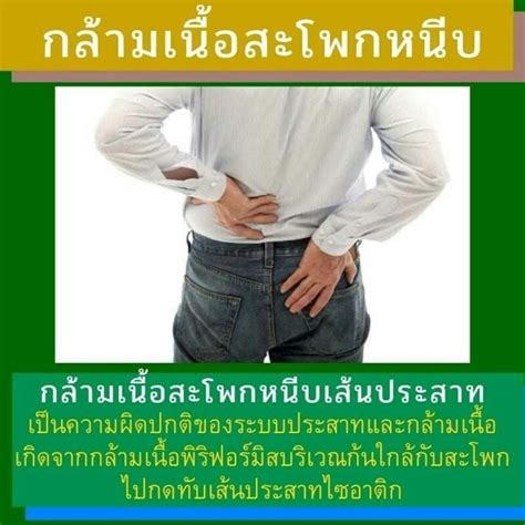 ⚠️อาการกล้ามเนื้อสะโพกหนีบเส้นประสาท Piriformis Syndrome โบราณเรียกกันว่า สลักเพชรจม เจ็บเส้น