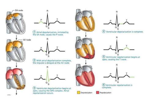 Congenital Heart Block