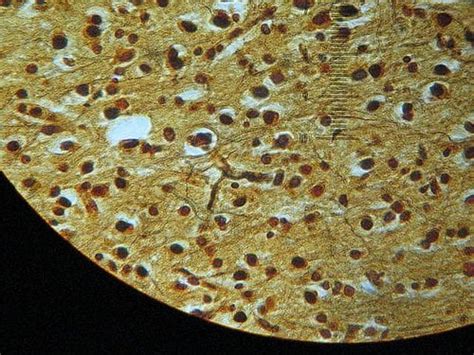 Cerebral Cortex Slide