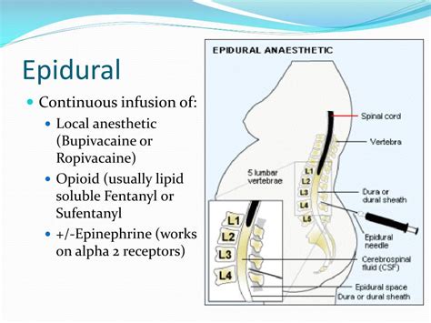 Ppt Management Of Labor Pain Powerpoint Presentation Free Download