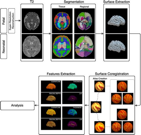 Processing Pipeline After Performing A Highresolution Reconstruction Download Scientific