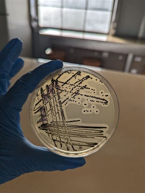 Quadrant Streak Of Staphylococcus Aureus On Baird Parker Agar Plate Stock Image Image Of