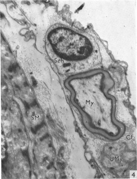 An Electron Micrograph Of One Of The Large Nerve Bundles Accompanying Download Scientific
