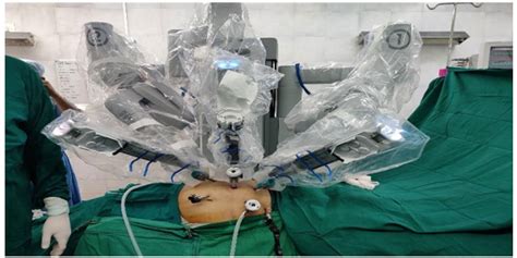 Is Robotic Assisted Partial Nephrectomy An Efficacious And Safe