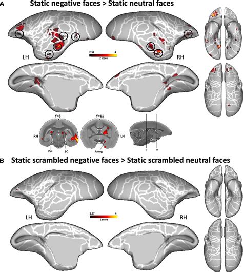 Face Selective Patches In Marmosets Are Involved In Dynamic And Static Facial Expression