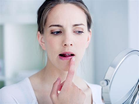 How To Get Rid Of A Pimple On Lip Treatments And Remedies