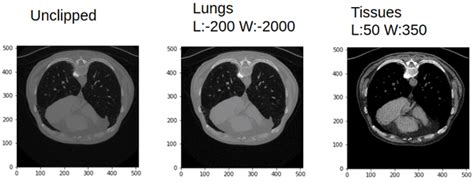 Introduction To Medical Image Processing With Python Ct Lung And