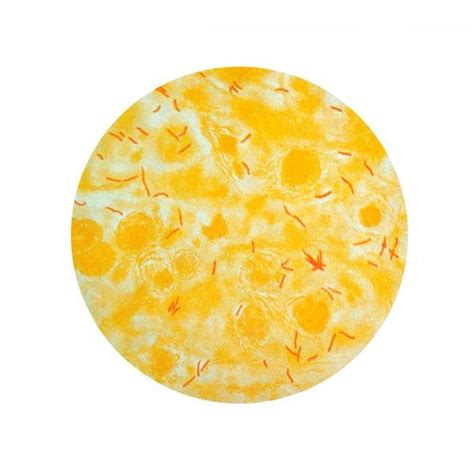 Image Acid Fast Stain Mycobacterium Tuberculosis Msd Manual