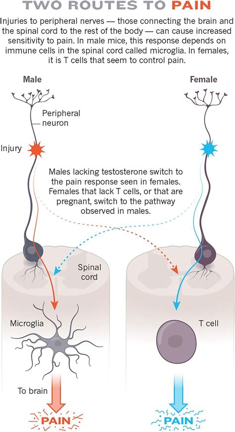 The Journal Of Bone And Joint Surgery Inc On Linkedin Sex And Gender Considerations In