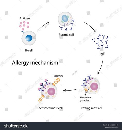 Allergy Mechanism Anaphylactic Reaction Allergic Reaction Stock Vector Royalty Free 2282083847