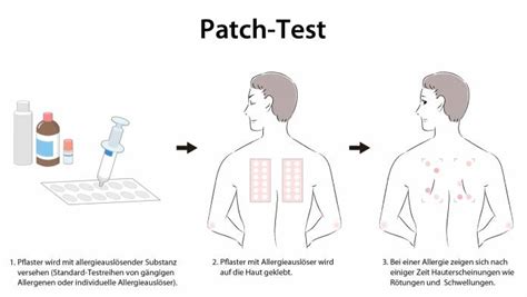 Patch Test