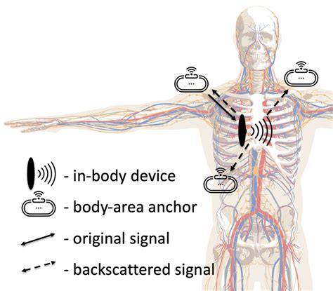 Schematics Of Different Types Of Rf Based In Body Localization
