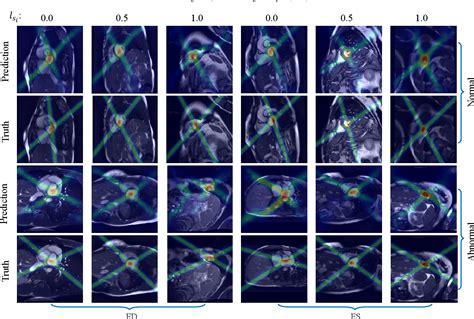 Figure From Self Supervised Learning For Medical Image Data With Anatomy Oriented Imaging