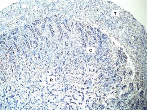 Ki67 Staining Of Fetal Testis On Day 68 Representative Low Power Â10