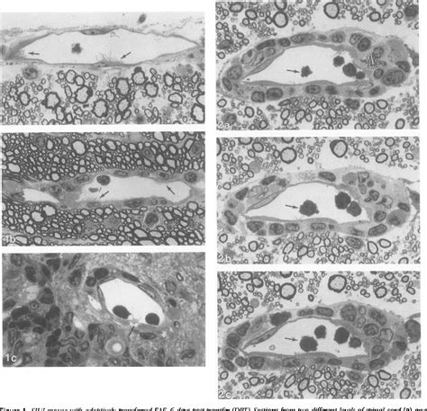 Figure 1 From Central Nervous System Endothelial Cell Polymorphonuclear