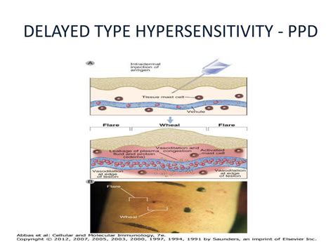 Ppt Hypersensitivity Reactions Powerpoint Presentation Free Download Id 1910577