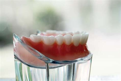 Your Dentist Can Determine If Denture Rebase Is Needed Design