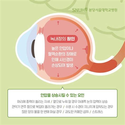 실명 부르는 녹내장 완치 불가능 조기 진단ㆍ관리가 요체 한국일보