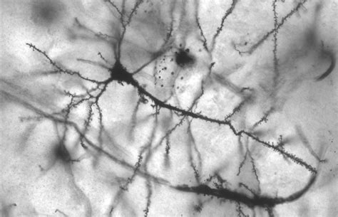 Dendritic Spines Learning