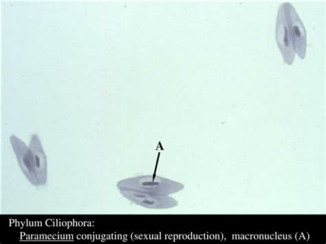 Ppt Kindgom Protista Phylum Ciliophora Phylum Sarcomastigophora