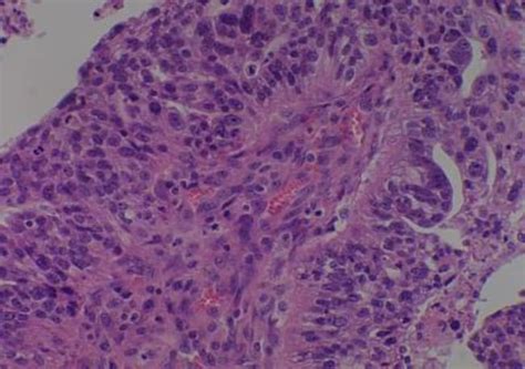 Novus Biologicals™ Human Ovary Tissue Microarray Cancer Slide Human Ovary Tissue Microarray