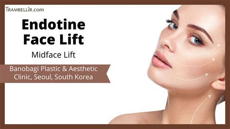 Endotine Face Lift Midface Lift Trambellir