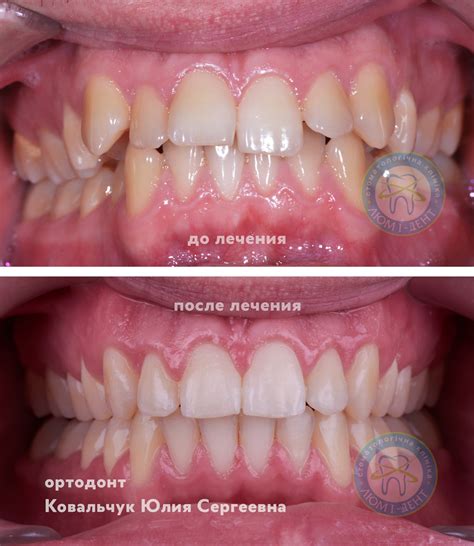 Ортодонт Киев Врач Стоматолог Цена Отзывы ЛюмиДент