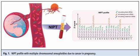 Explain The Cause Of False Positive Results In Nipt Test