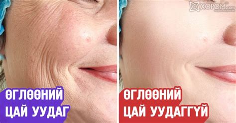 Хэрэв та өдөр бүр өглөөний цайгаа уухгүй яваад байвал таны биед юу тохиолдох вэ