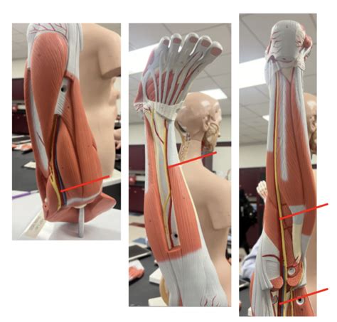 Lower Limb Arteries Diagram Quizlet