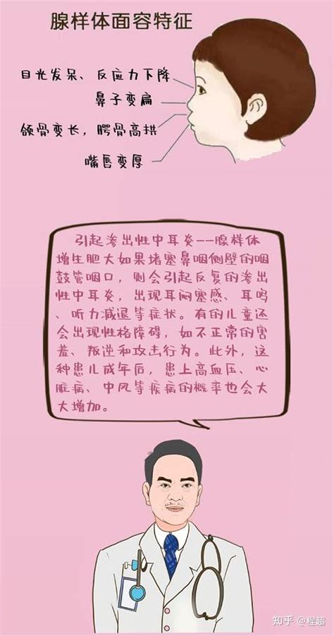 小孩打呼噜那些事儿 知乎