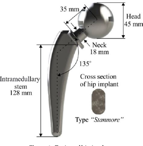 Figure 2 From Finite Element Analysis Of Orthopedic Hip Implant With Functionally Graded