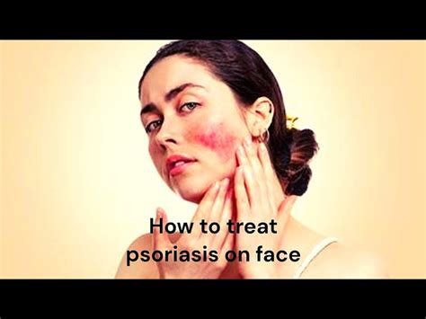 Psoriasis Skin Face Treatment