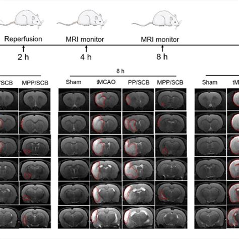 In Vivo Mri Assay In Transient Middle Cerebral Artery Occlusion Rats Download Scientific