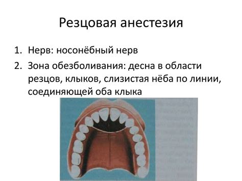 Проводниковая анестезия презентация онлайн