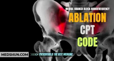 Understanding The Ablation Radiofrequency Aflutter Procedure Exploring The Esi Cpt Code MedShun